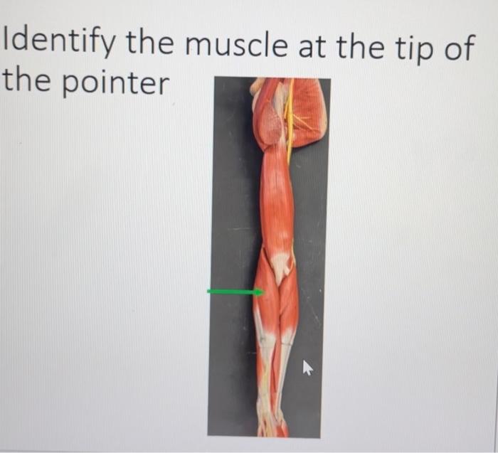 Solved Identify the miscrle st tho tin of Identify | Chegg.com
