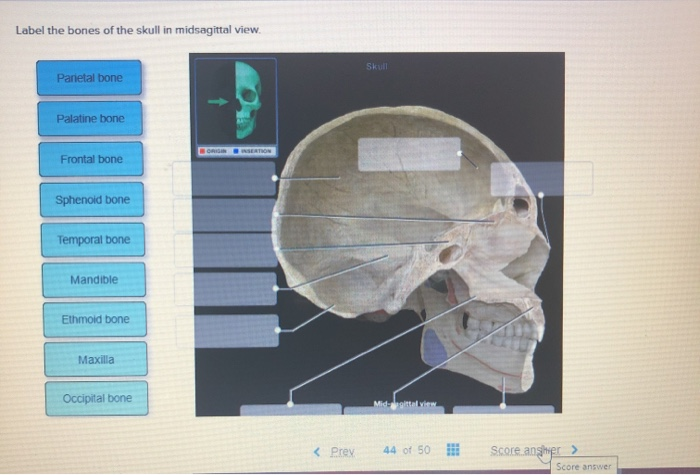 Solved Label The Bones Of The Skull In Midsagittal View
