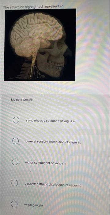 Solved The structure highlighted represents? Multiple Choice | Chegg.com