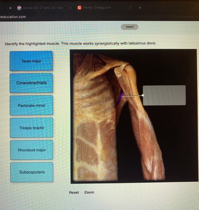 Solved nerves C6 C7 and C8 - Goo C Home | Chegg.com | Chegg.com