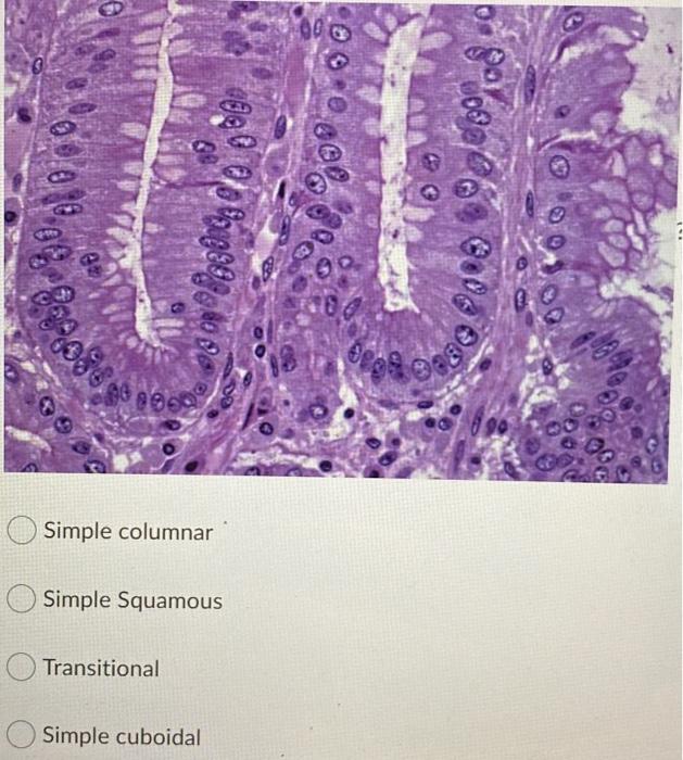 Solved what type of tissue is in this image lining the | Chegg.com