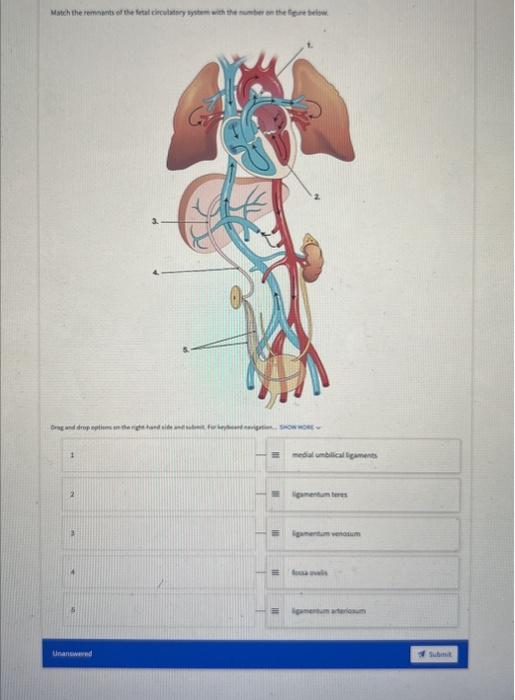 Solved Match The Remenents Of The Fetal Cleculatsory Lynhem