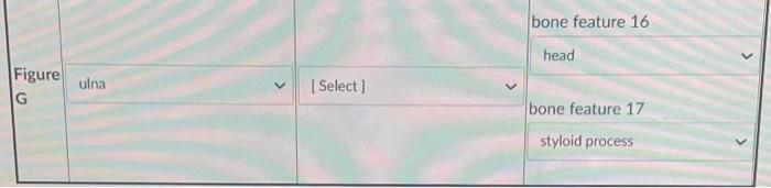 Label the upper limb bone \& portion | Chegg.com