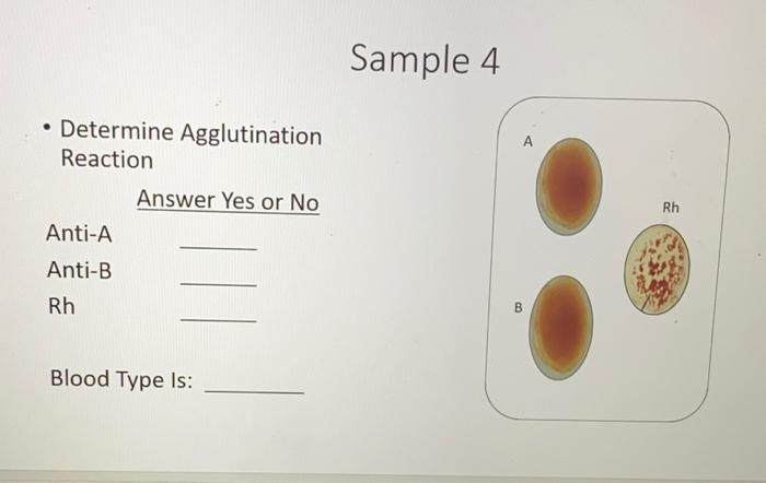 Solved Sample 3 • Determine Agglutination Reaction Answer | Chegg.com