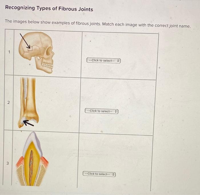 Solved Recognizing Types of Fibrous Joints The images below | Chegg.com Solved Recognizing Types of Fibrous Joints The images below | Chegg.com