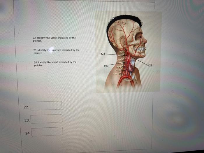 Solved 22. Identify the vessel indicated by the pointer ma | Chegg.com