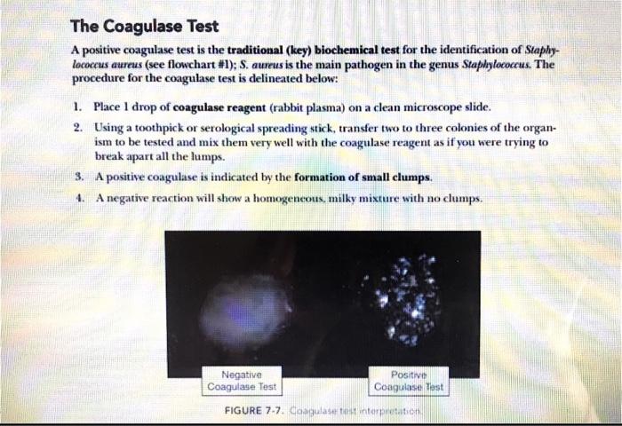 Solved The PYR (Pyrolidonyl Arylamidase) Test The PYR test | Chegg.com