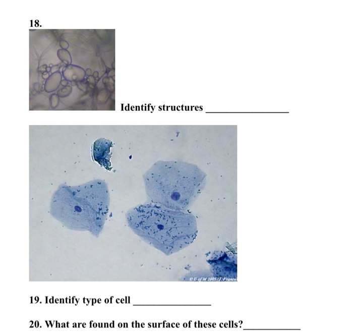 Solved Identify structures 19. Identify type of cell 20. | Chegg.com