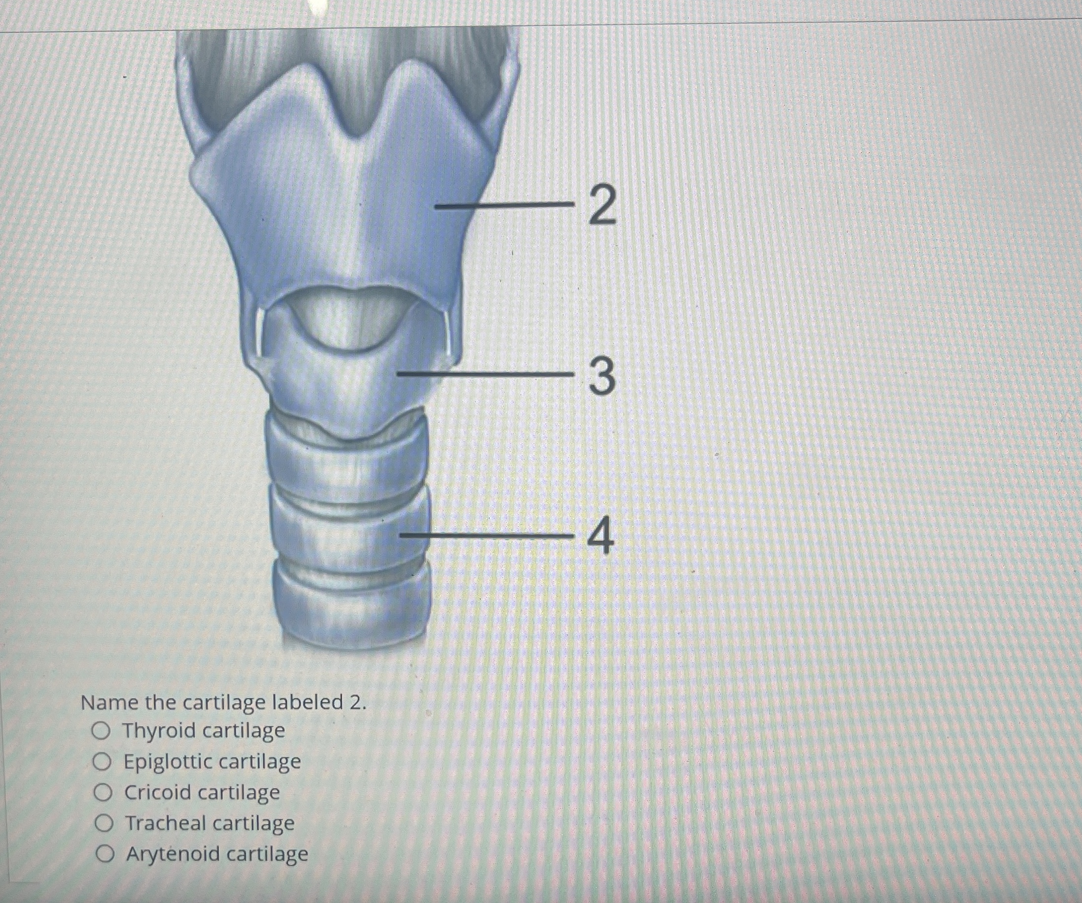 Solved Name the cartilage labeled 2 ﻿Thyroid cartilage | Chegg.com