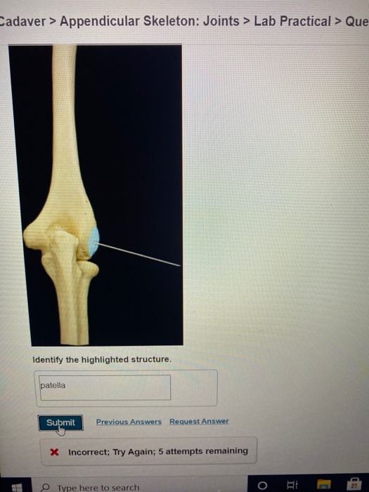 Solved Cadaver > Appendicular Skeleton: Joints > Lab | Chegg.com Solved Cadaver > Appendicular Skeleton: Joints > Lab | Chegg.com