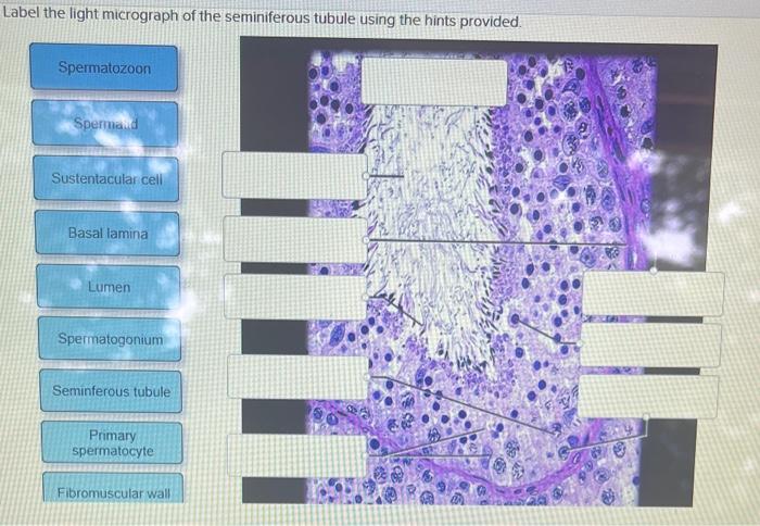 Solved abel the light micrograph of the seminiferous tubule | Chegg.com