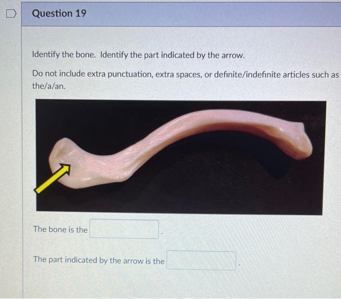 Solved Question 18 What is the action of the brachioradialis | Chegg.com