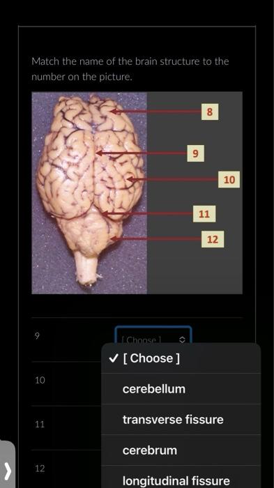 Solved Match the name of the brain structure to the number | Chegg.com