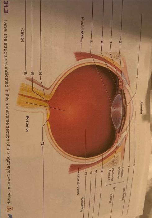 Solved 31.3 Label the structures indicated in this | Chegg.com