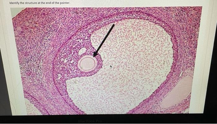 Solved Identify the structure at the end of the pointer | Chegg.com