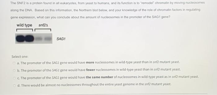 Solved The next two questions relate to the Northern blot | Chegg.com