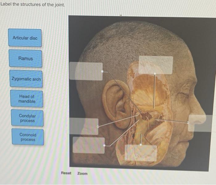 Solved Label the structures of the joint. Articular disc | Chegg.com
