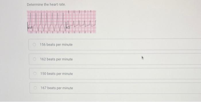 Solved Identify the rate and rhythm. ليليليليليل O 150 BPM; | Chegg.com