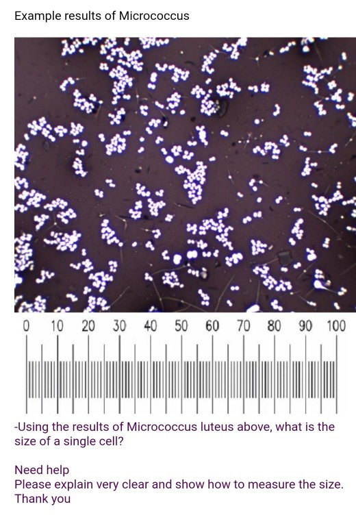 Solved Example results of Micrococcus 0 10 20 30 40 40 50 60 | Chegg.com