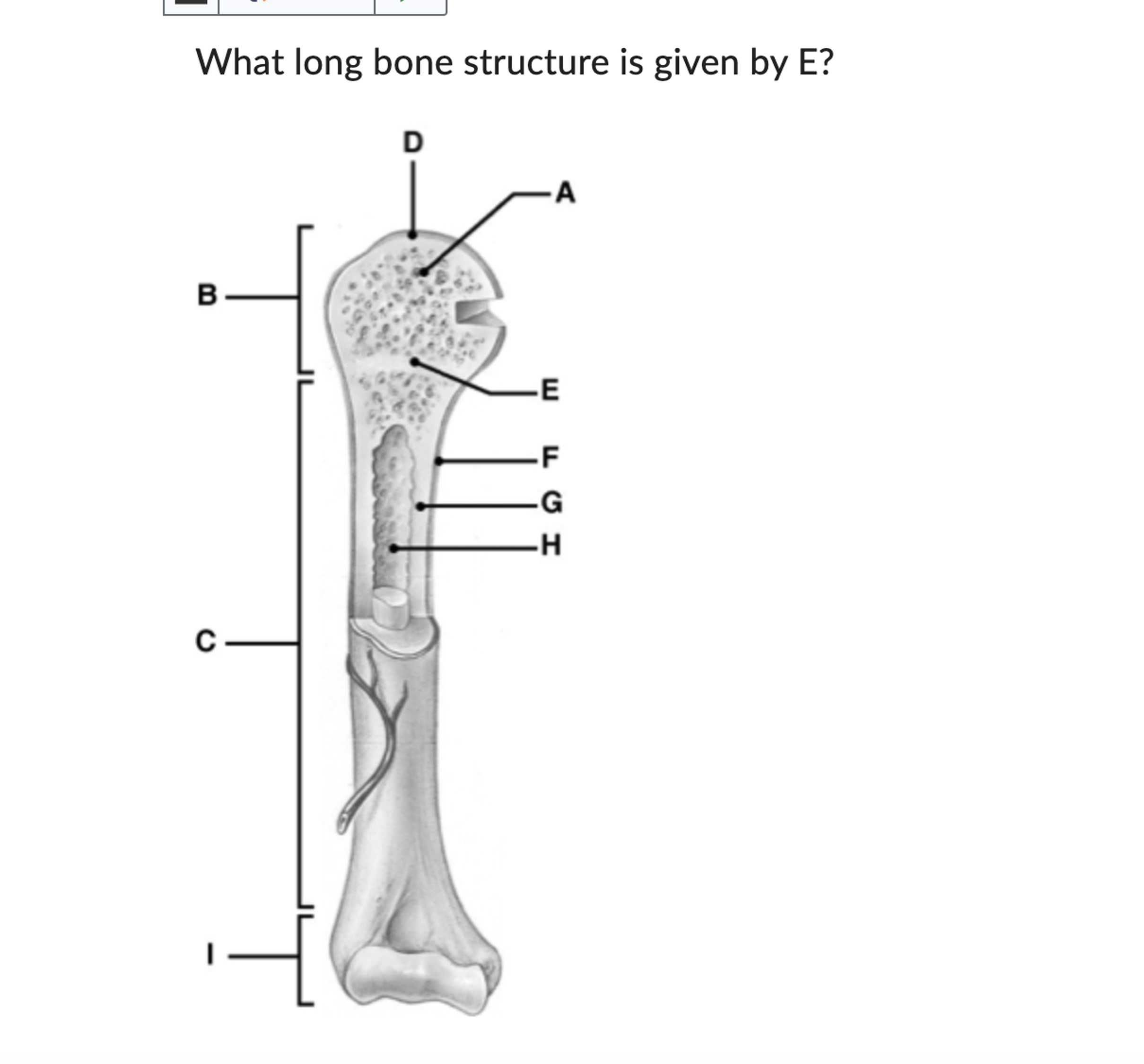 Solved What long bone structure is given by E ? | Chegg.com