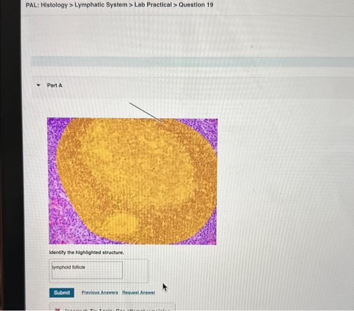 Solved PAL: Histology > Lymphatic System > Lab Practical > | Chegg.com Solved PAL: Histology > Lymphatic System > Lab Practical > | Chegg.com