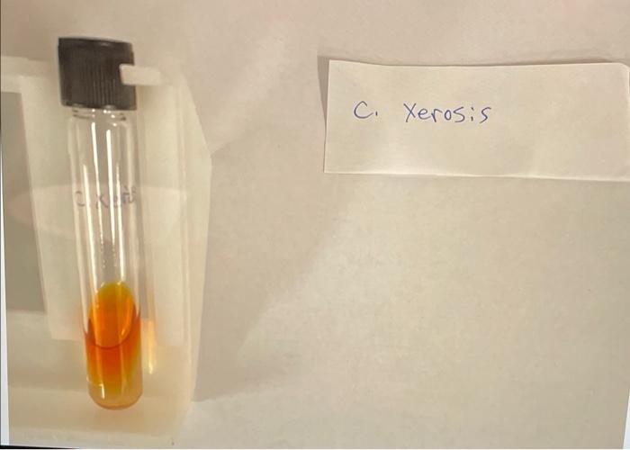Solved PART B: Methyl Red Test and Voges-Proskauer Test | Chegg.com