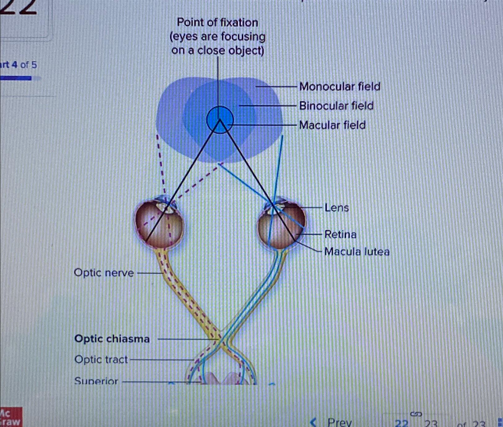 Solved Point of fixation (eyes are focusingon a close | Chegg.com