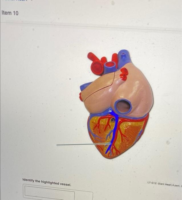 Solved What structure is highlighted? A Do these vessels | Chegg.com
