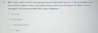 Solved Bell's palsy, which results in drooping of the | Chegg.com