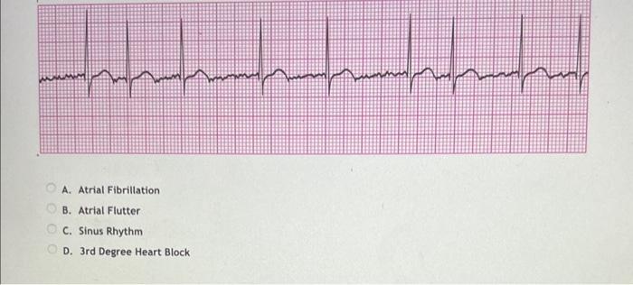 Solved 1. Rhythm Interpretation -. Interpret the rhythm | Chegg.com