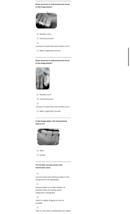 Solved Radiolucent structures INCLUDE: a. The maxillary | Chegg.com