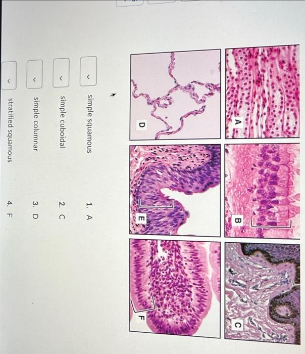 Solved D simple squamous simple cuboidal simple columnar | Chegg.com