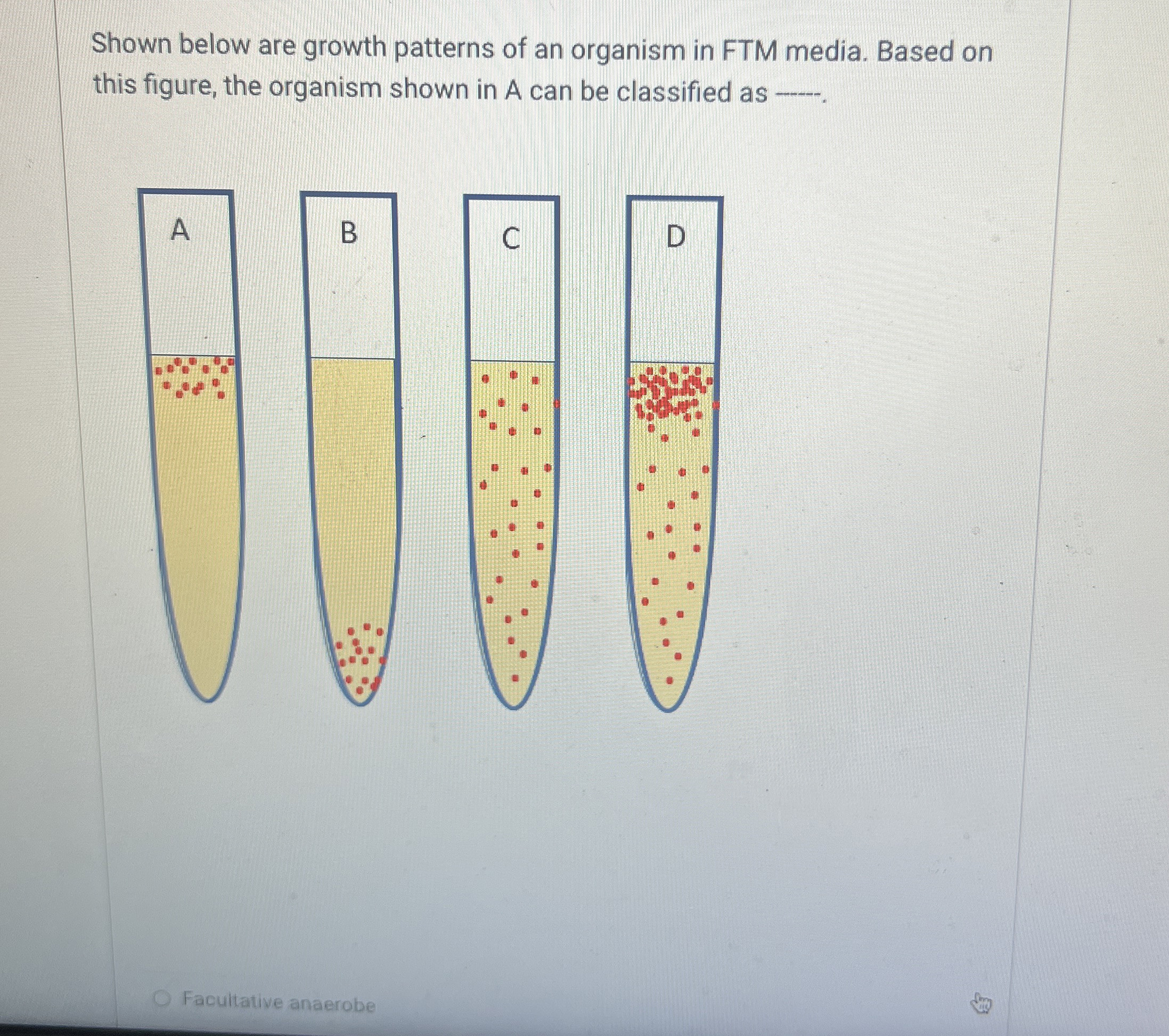 Solved Shown below are growth patterns of an organism in FTM | Chegg.com