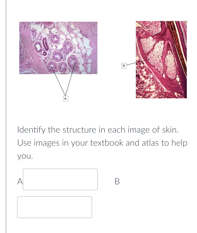 Solved Identify the structure in each image of skin. Use | Chegg.com
