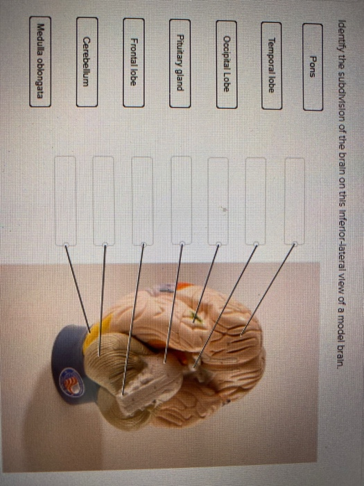 Solved Identify the subdivision of the brain on this | Chegg.com
