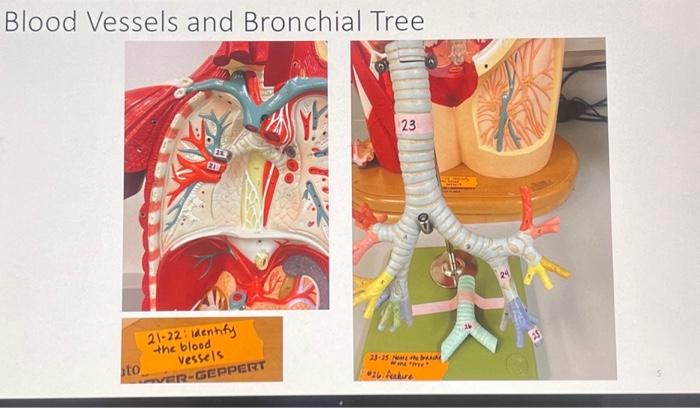 Lung Blood Vessels and Bronchial Tree Muscles of | Chegg.com