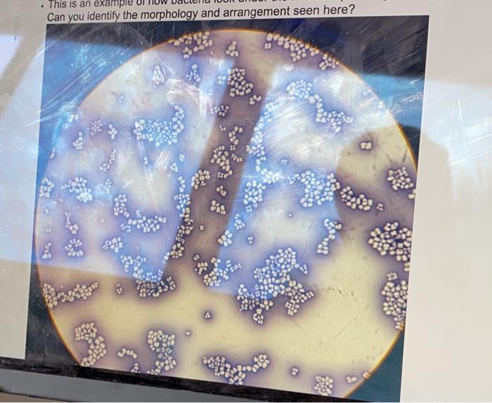 Solved Ex. 1: Bacteria in Your Hands 1. Take a closer look | Chegg.com