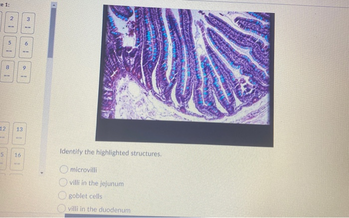Solved | ය 6 9 13 16 Identify the highlighted structures. | Chegg.com