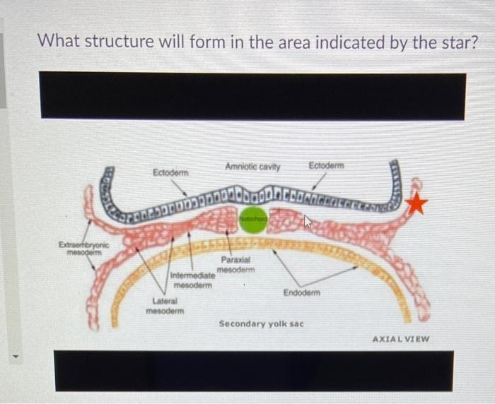 Solved Amniotic cavity Ectoderm Ectoderm palodalcune PREPARE | Chegg.com
