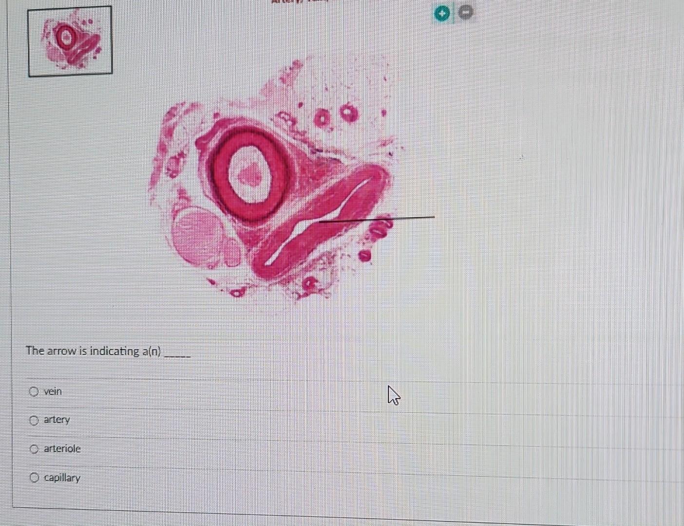 Solved The arrow is indicating a(n) vein artery arteriole | Chegg.com