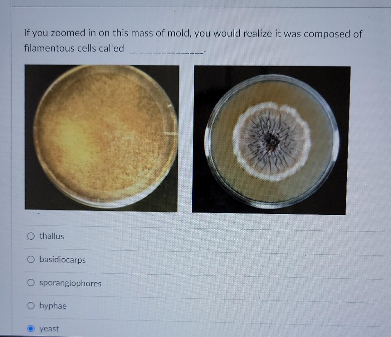 Solved If you zoomed in on this mass of mold, you would | Chegg.com