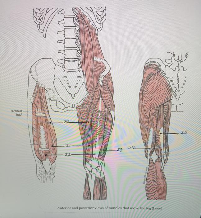 Solved Epicranial aponeurosis 2 4 3 Lateral view of muscles | Chegg.com