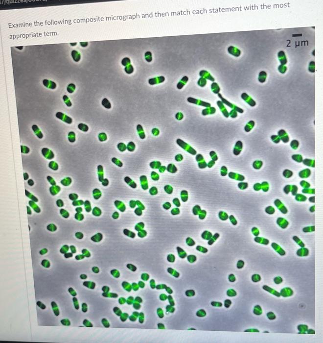 Solved The fluorescent label in this image is The cell | Chegg.com