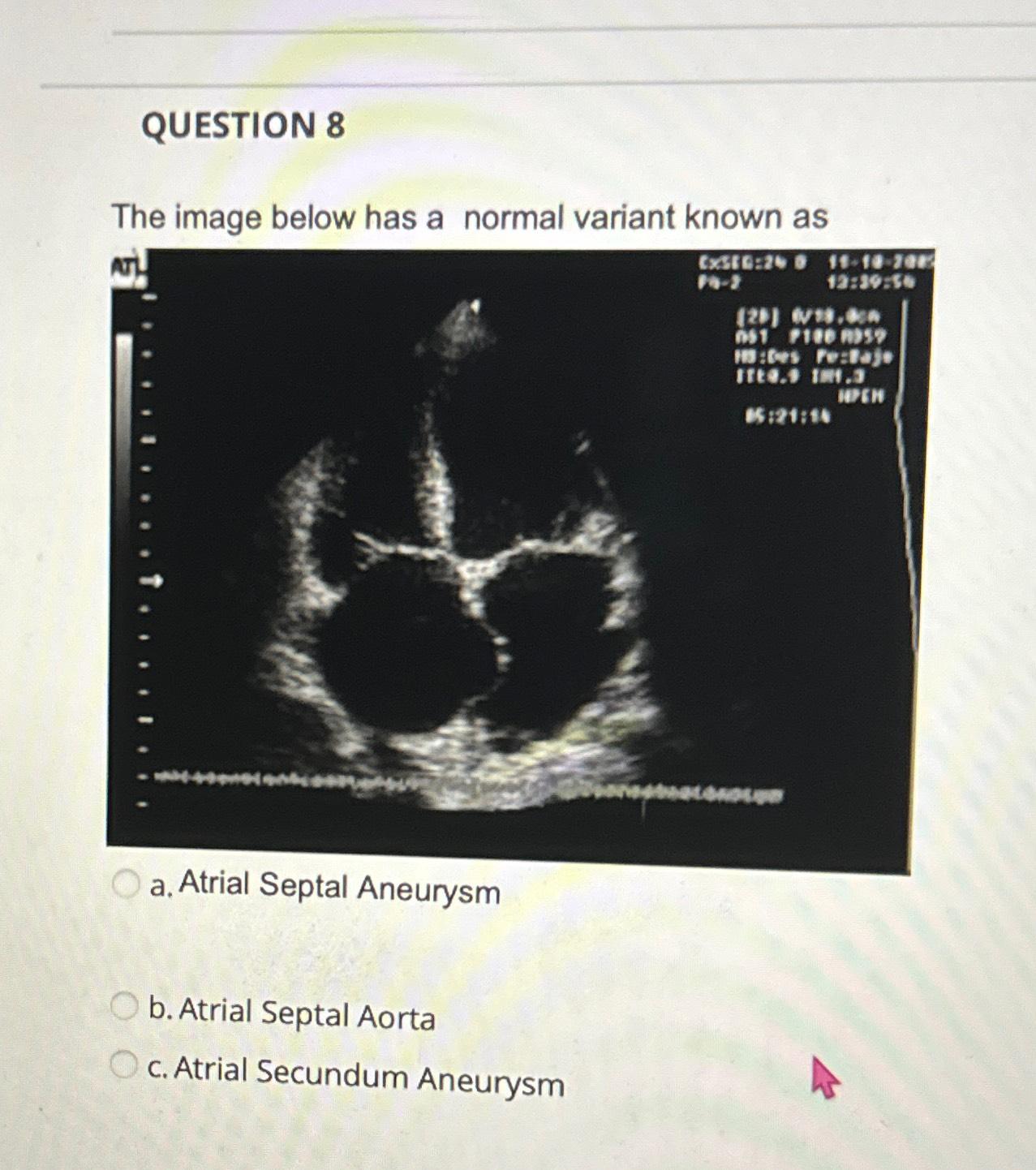 Solved QUESTION 8The image below has a normal variant known | Chegg.com