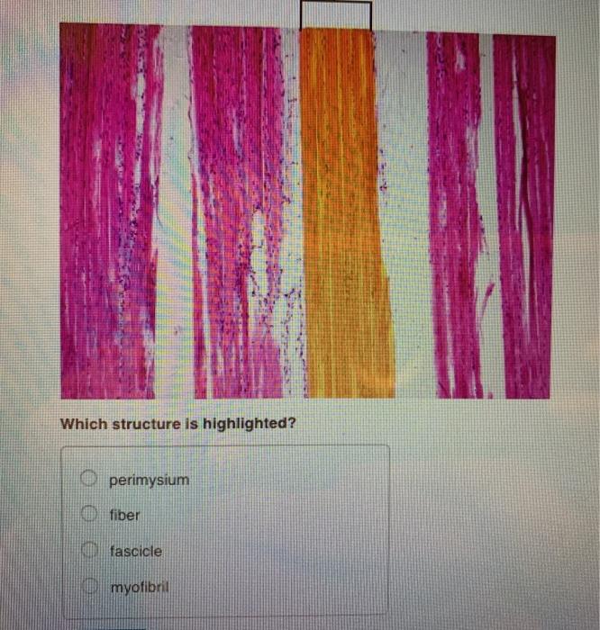 Solved Which structure is highlighted? perimysium 0 fiber | Chegg.com