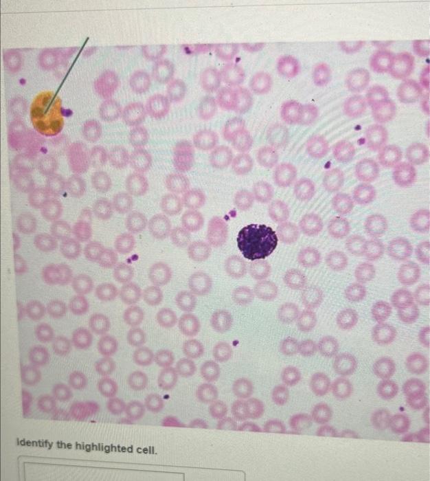 Solved Identify the highlighted cell. | Chegg.com