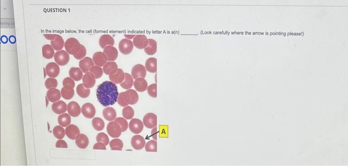 Solved in the image below, the cell (formed element) | Chegg.com