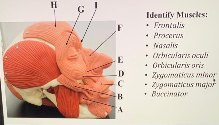 Solved Identify Muscles: - Frontalis - Procerus - Nasalis - | Chegg.com