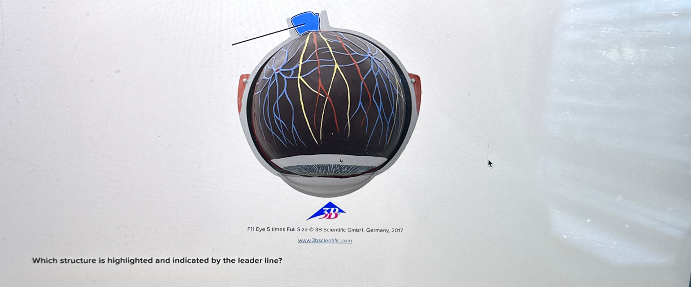 Solved F11 ﻿Eye 5 ﻿times Full Size (C) 3B Scientific GmbH, | Chegg.com