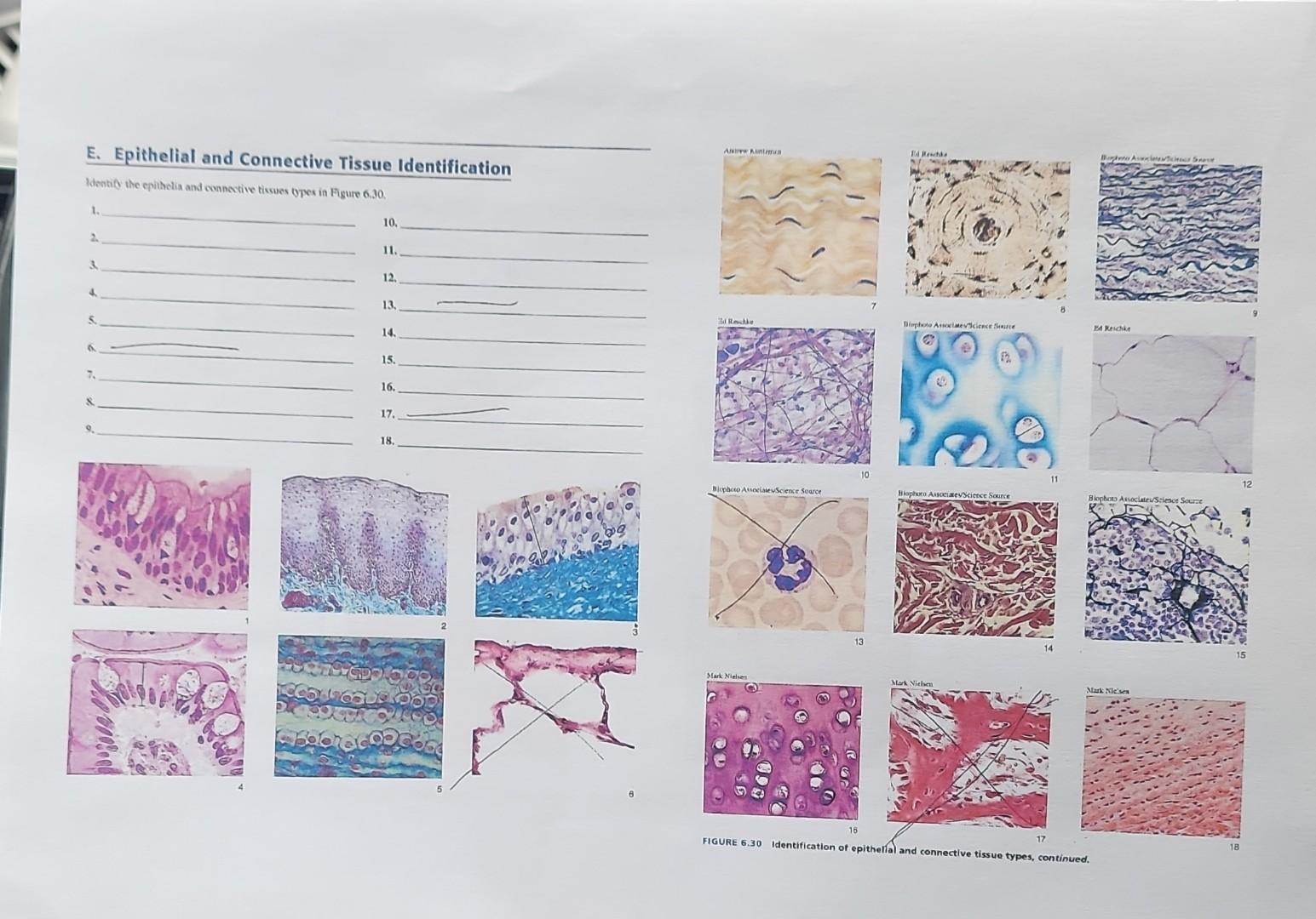 Solved E. Epithelial and Connective Tissue Identification | Chegg.com